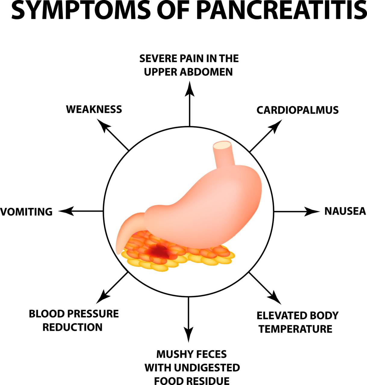 Pancreatitis and Alcohol - Rehab Guide Pancreatitis and Alcohol - Rehab Guide